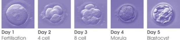 FET Cycle – it’s all happening this week! – The year of YEAH!